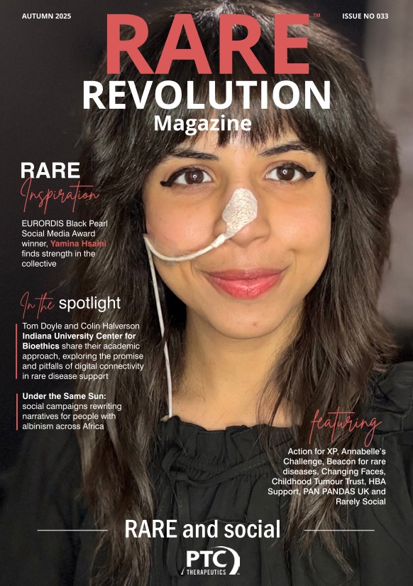 Rare Revolution